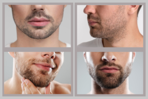 5 O’Clock Shadow Beard Guide to Avoid Patchy or Uneven Stubble